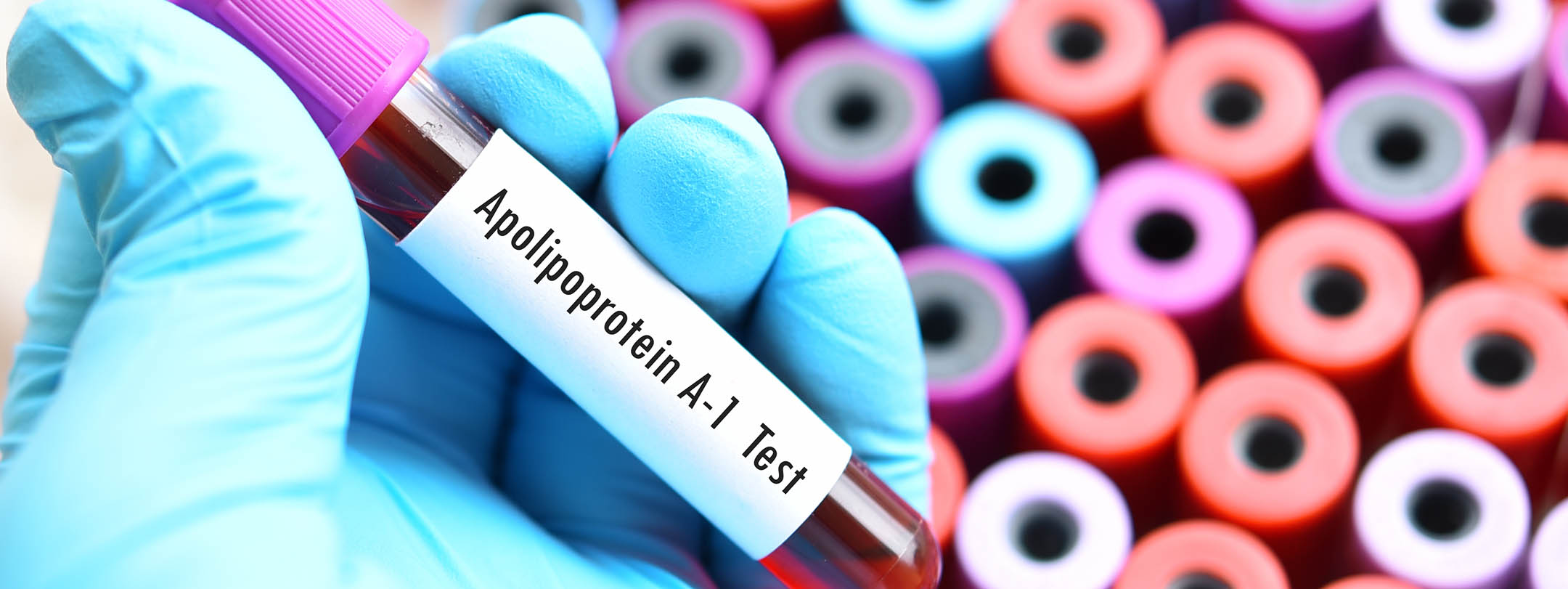 Apolipoprotein A1 VisitHealth Apolipoprotein A1 VisitHealth